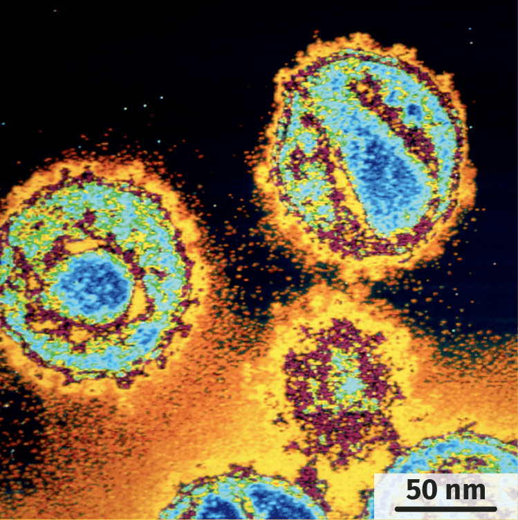 Le VIH, pathogène à transmission directe | Lelivrescolaire.fr