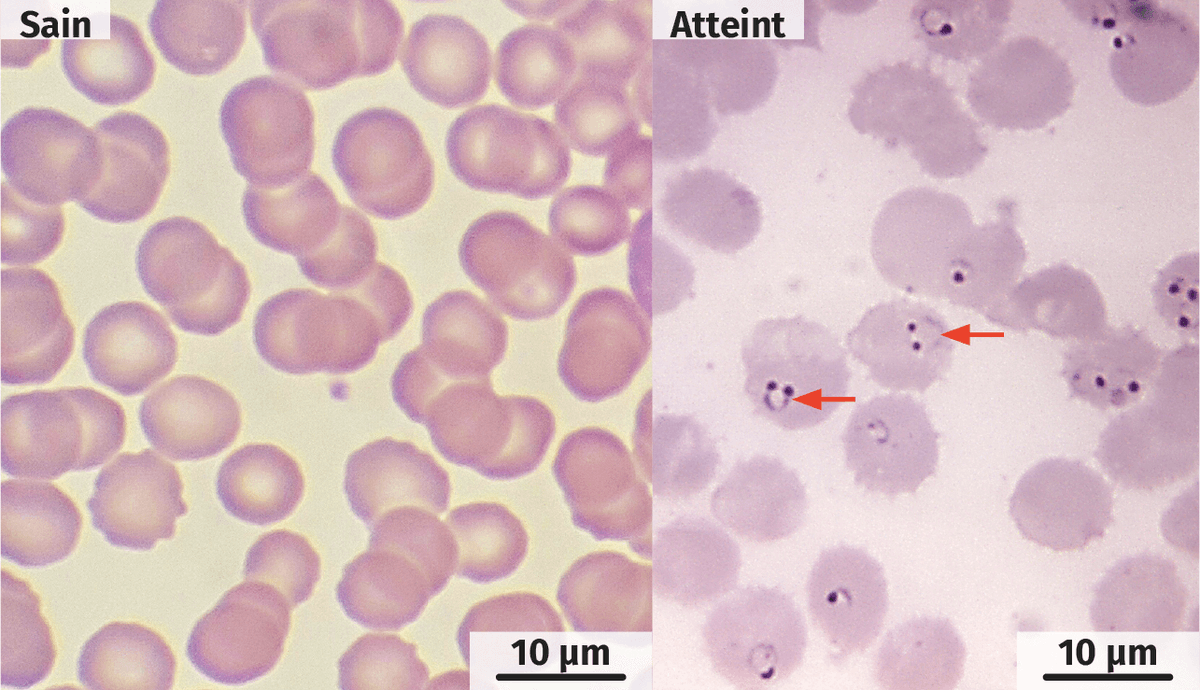 Le paludisme, maladie à transmission vectorielle | Lelivrescolaire.fr