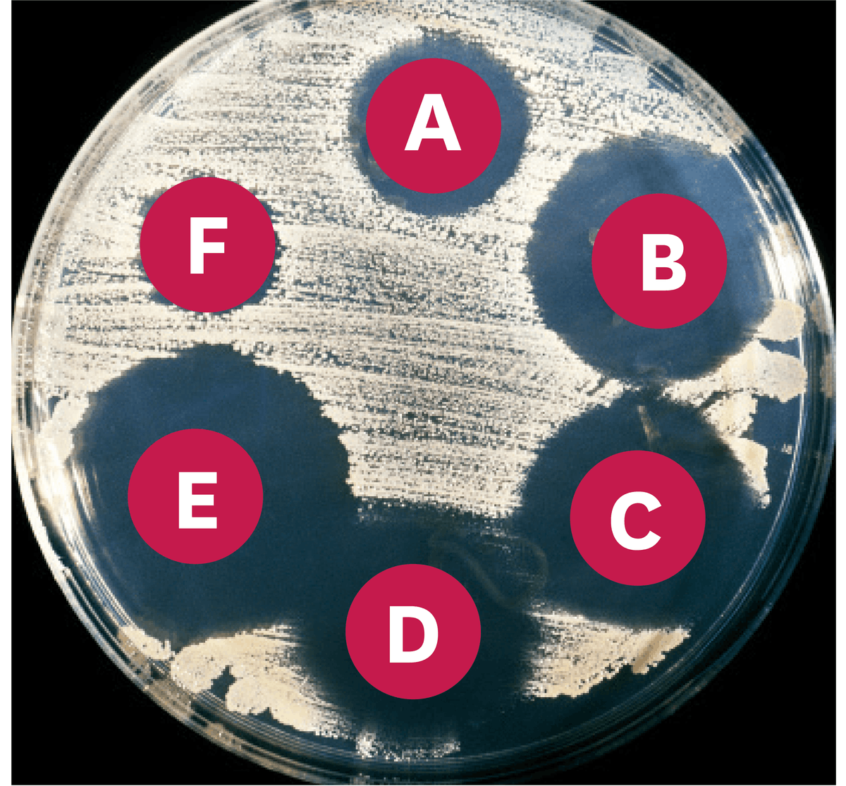 Comment utiliser les antibiotiques ? | Lelivrescolaire.fr